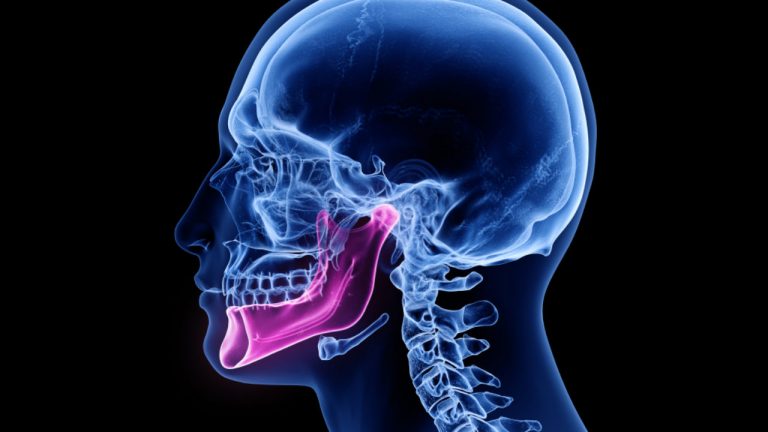 What Are the Symptoms and Risk Factors of TMJ Disorders? - 2021 Guide ...